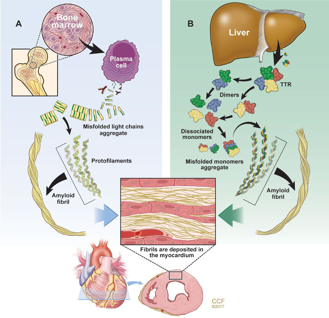 Cardiag Study – Life Molecular Imaging