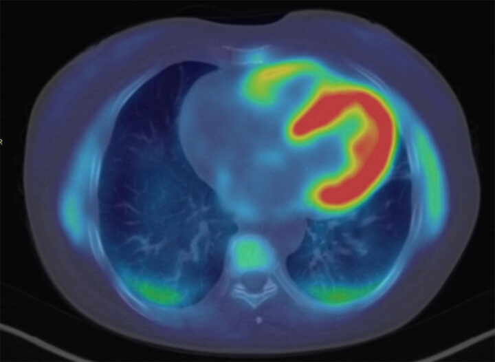 Cardiag Study – Life Molecular Imaging